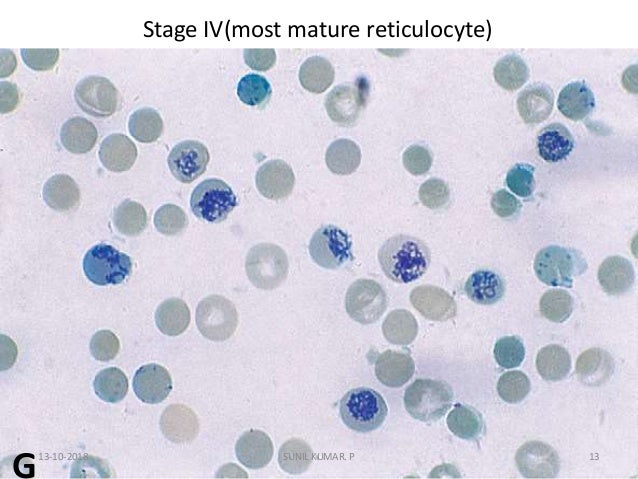 Reticulocyte count