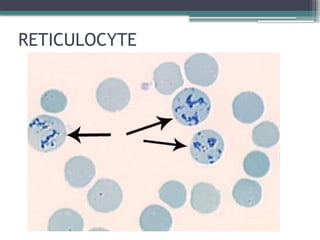 RETICULOCYTE COUNT- details including findings | PPTX