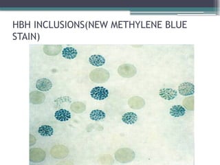 RETICULOCYTE COUNT- details including findings | PPTX