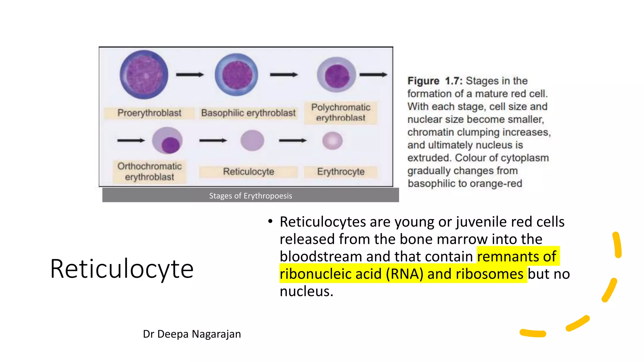 Other tests in hemolytic anaemia workup | PPTX