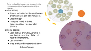 Other tests in hemolytic anaemia workup | PPT