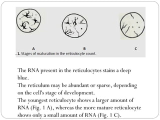 Reticulocytes | PPT