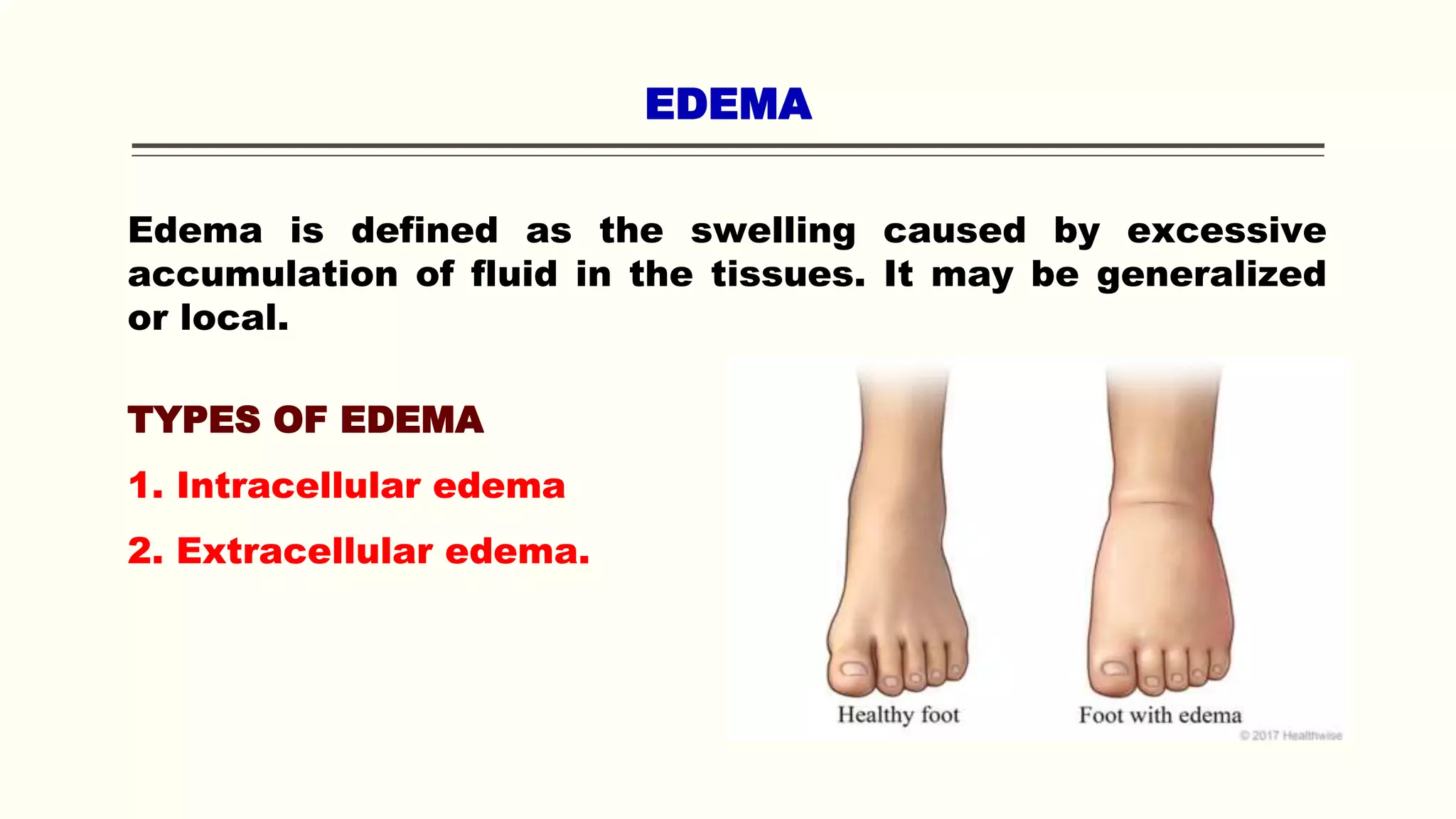 Reticuloendothelial System, Tissue Macrophages, Lymphatic System.pptx
