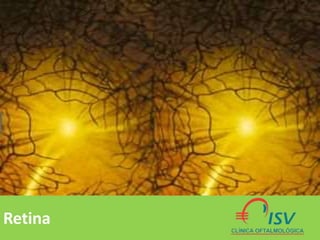 Retina | PPTX