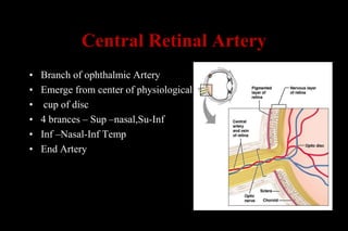 Retina | PPT
