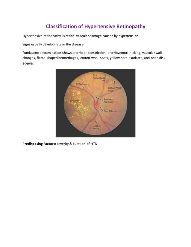 Retina (Define ,anatomy of retina, examination of retina ...