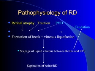 Retina 5 retinal detachment 09.06.16 - dr.k.n.jha