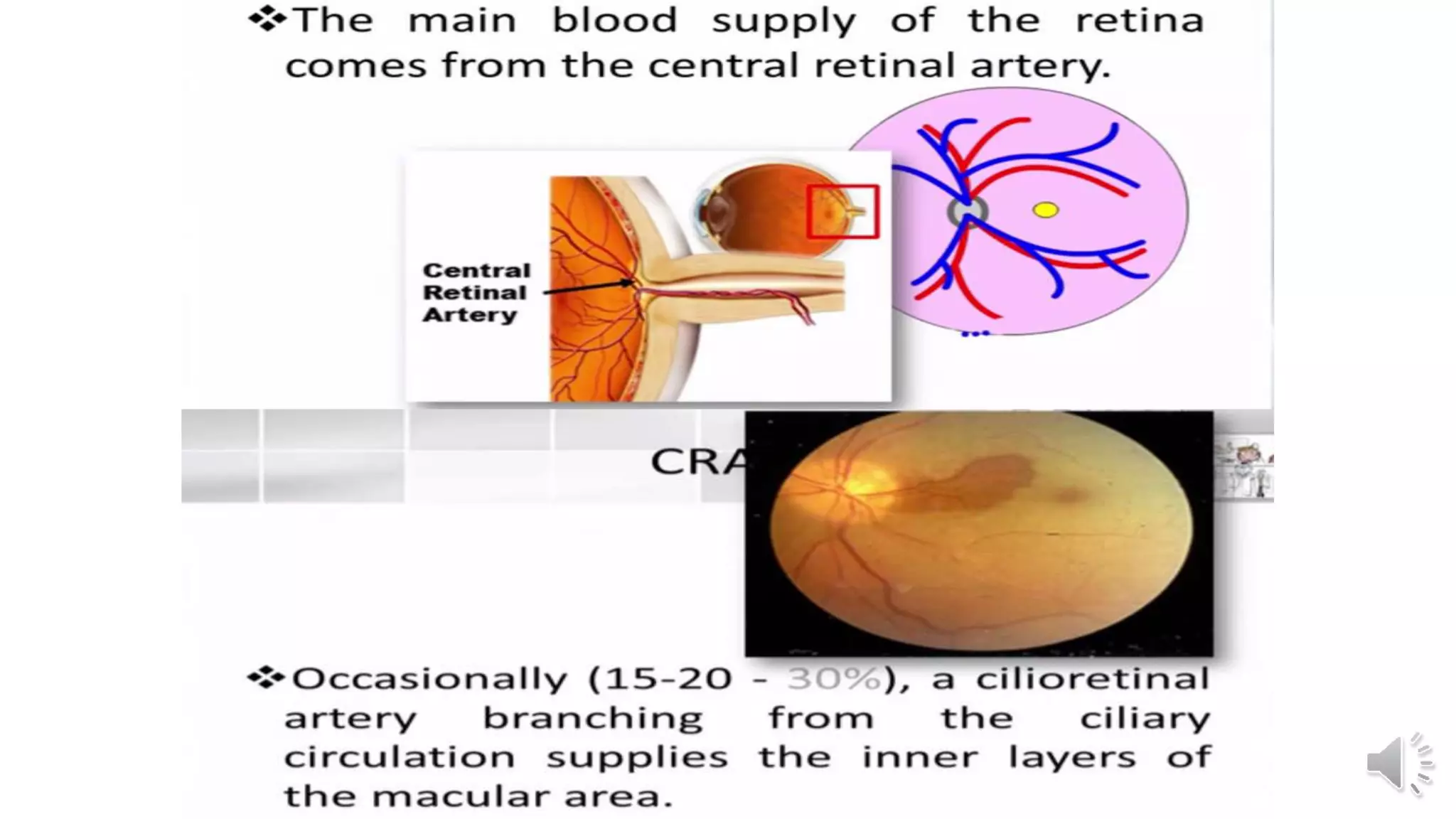 Retina Central Retinal Artery Occlusion | PPTX