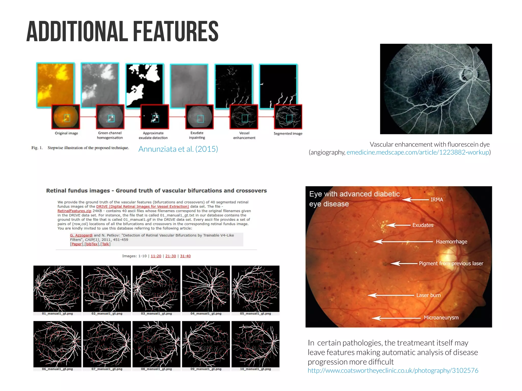 Shallow introduction for Deep Learning Retinal Image Analysis | PDF ...