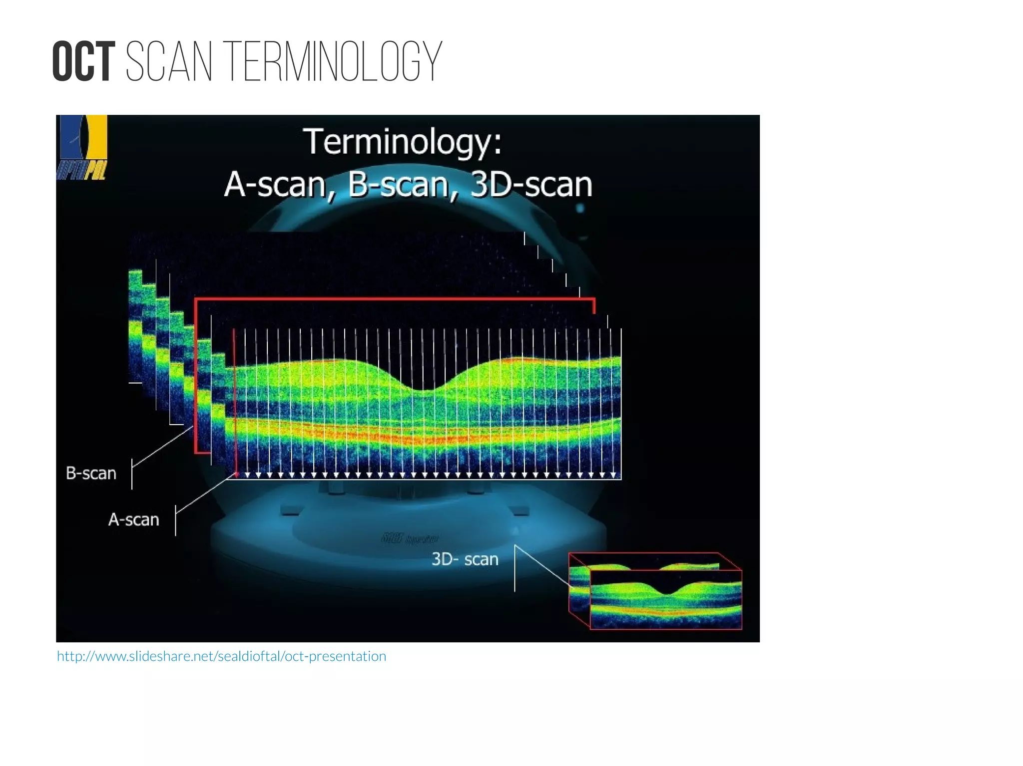 Shallow introduction for Deep Learning Retinal Image Analysis | PDF ...