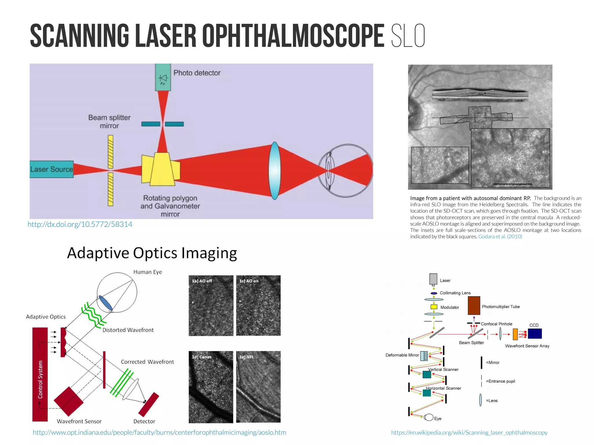 Shallow introduction for Deep Learning Retinal Image Analysis | PDF | Eye and Vision Conditions ...