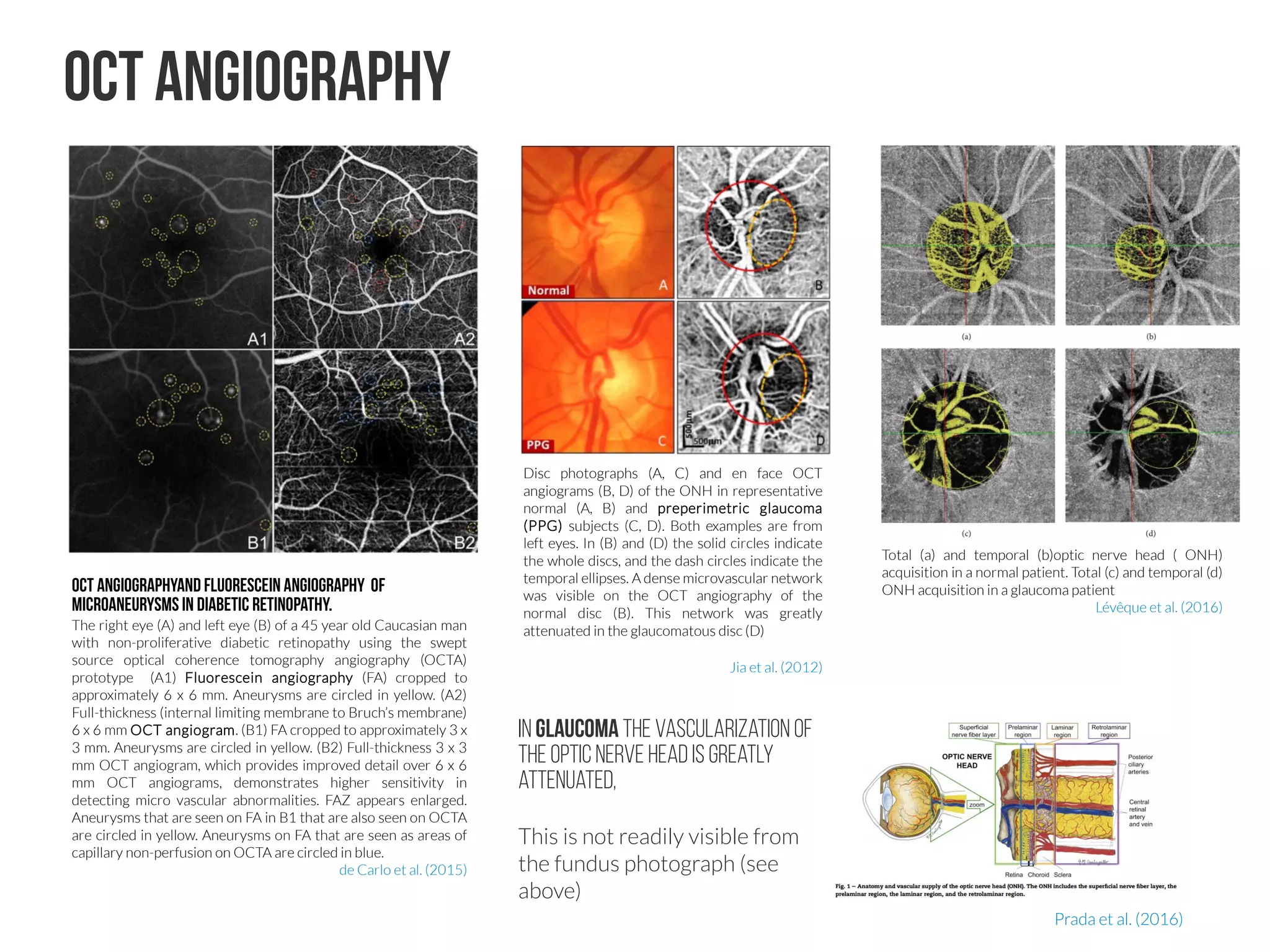 Shallow introduction for Deep Learning Retinal Image Analysis | PDF | Eye and Vision Conditions ...