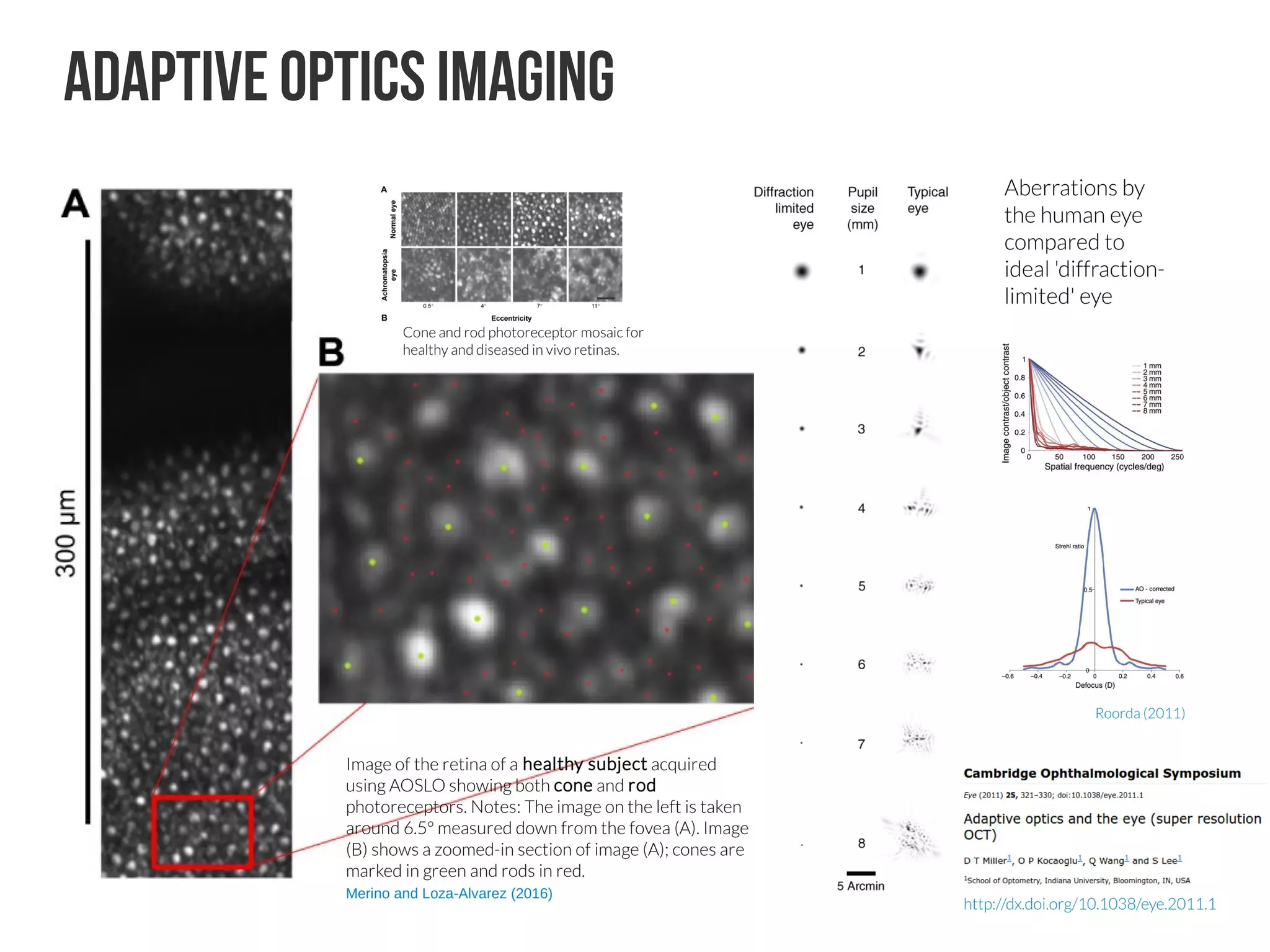 Shallow introduction for Deep Learning Retinal Image Analysis | PDF | Eye and Vision Conditions ...