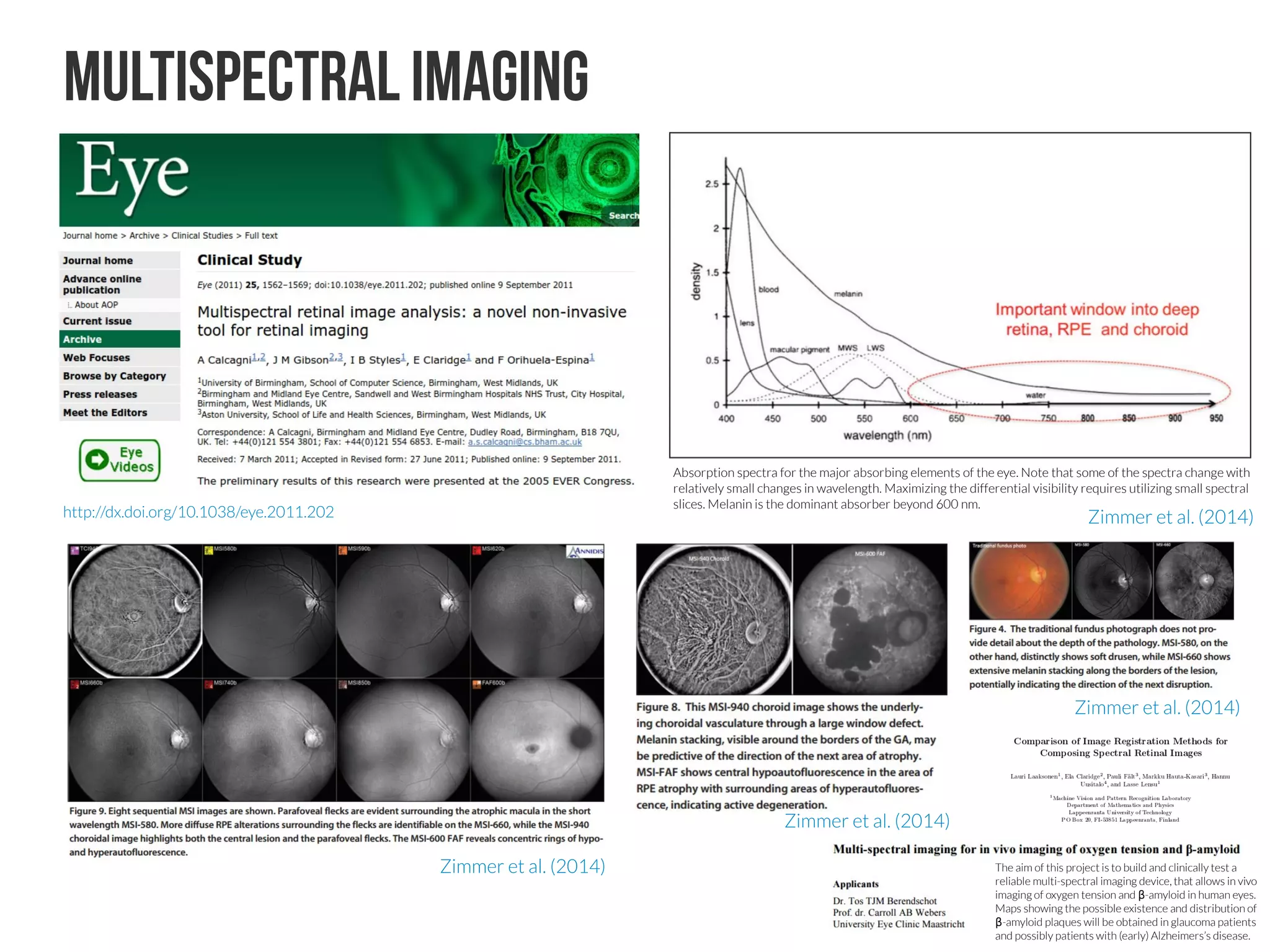 Shallow introduction for Deep Learning Retinal Image Analysis | PDF ...