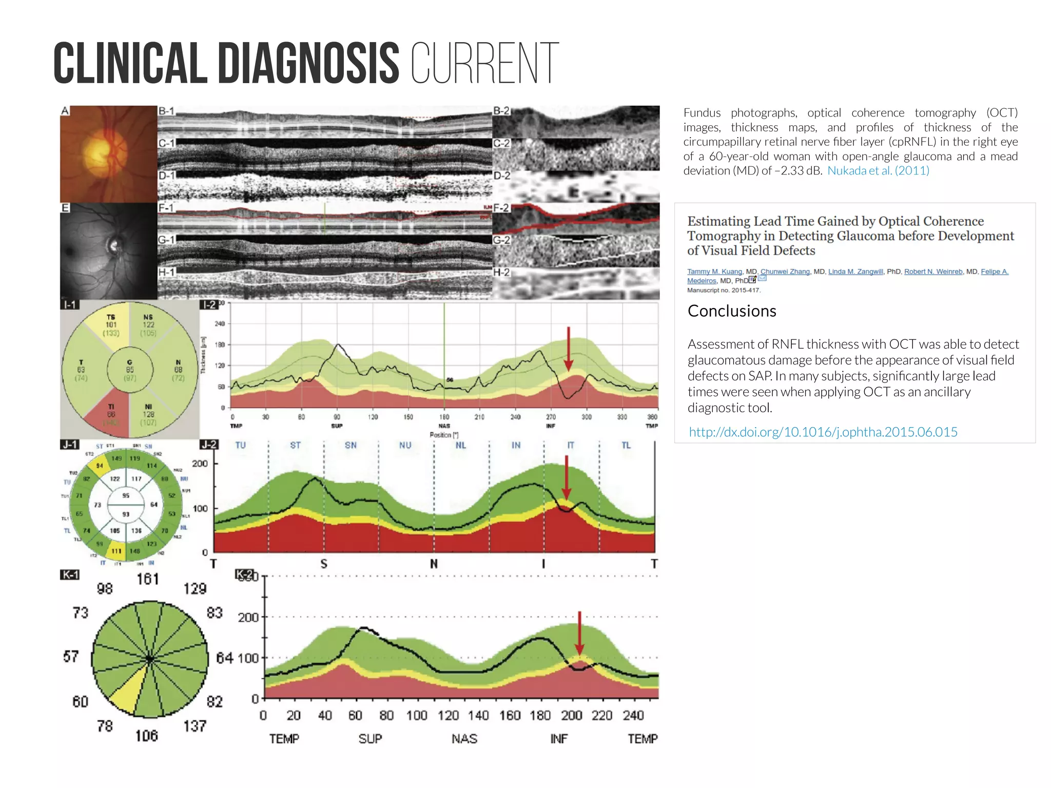 Shallow introduction for Deep Learning Retinal Image Analysis | PDF ...