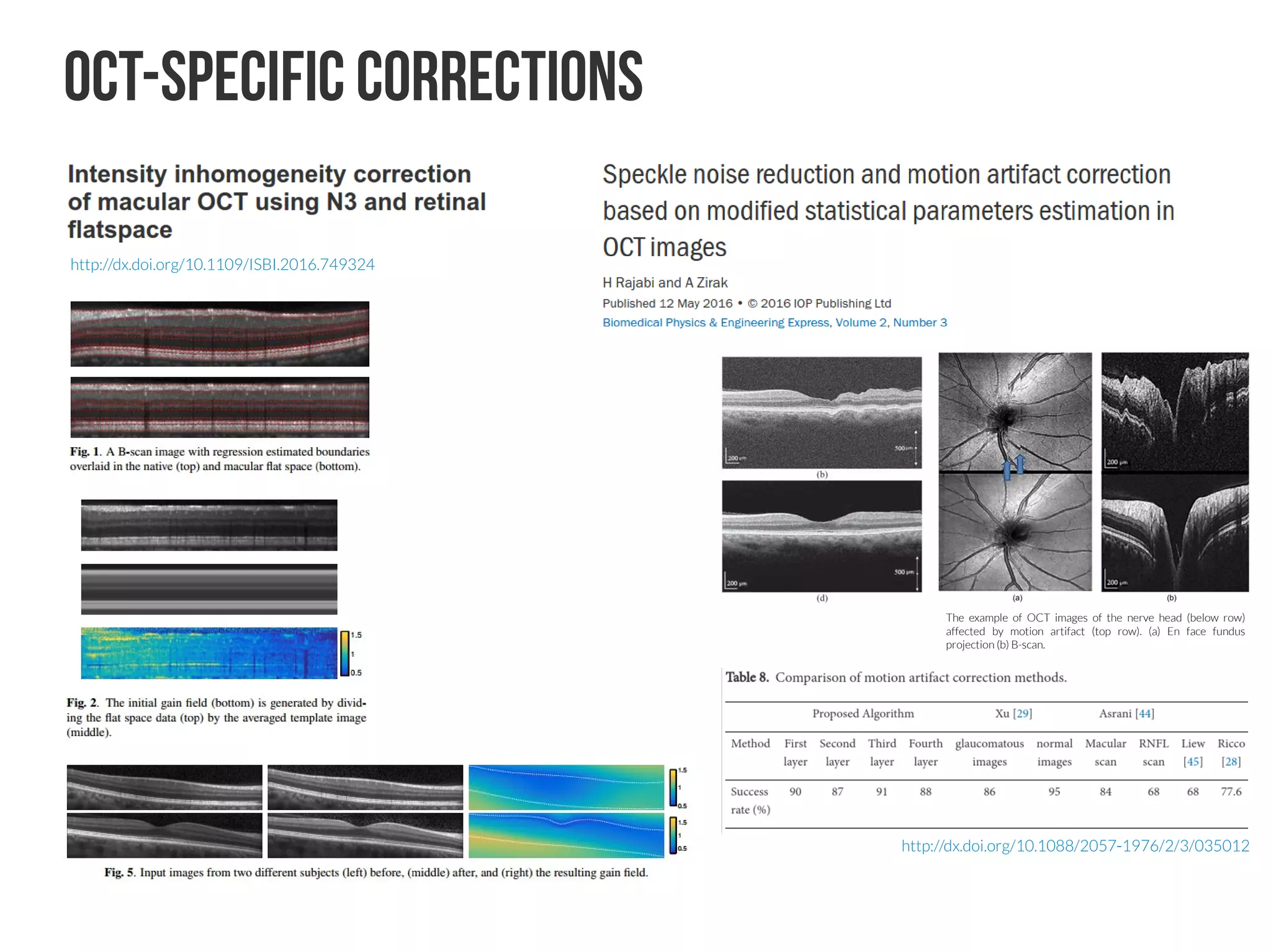 Shallow introduction for Deep Learning Retinal Image Analysis | PDF ...