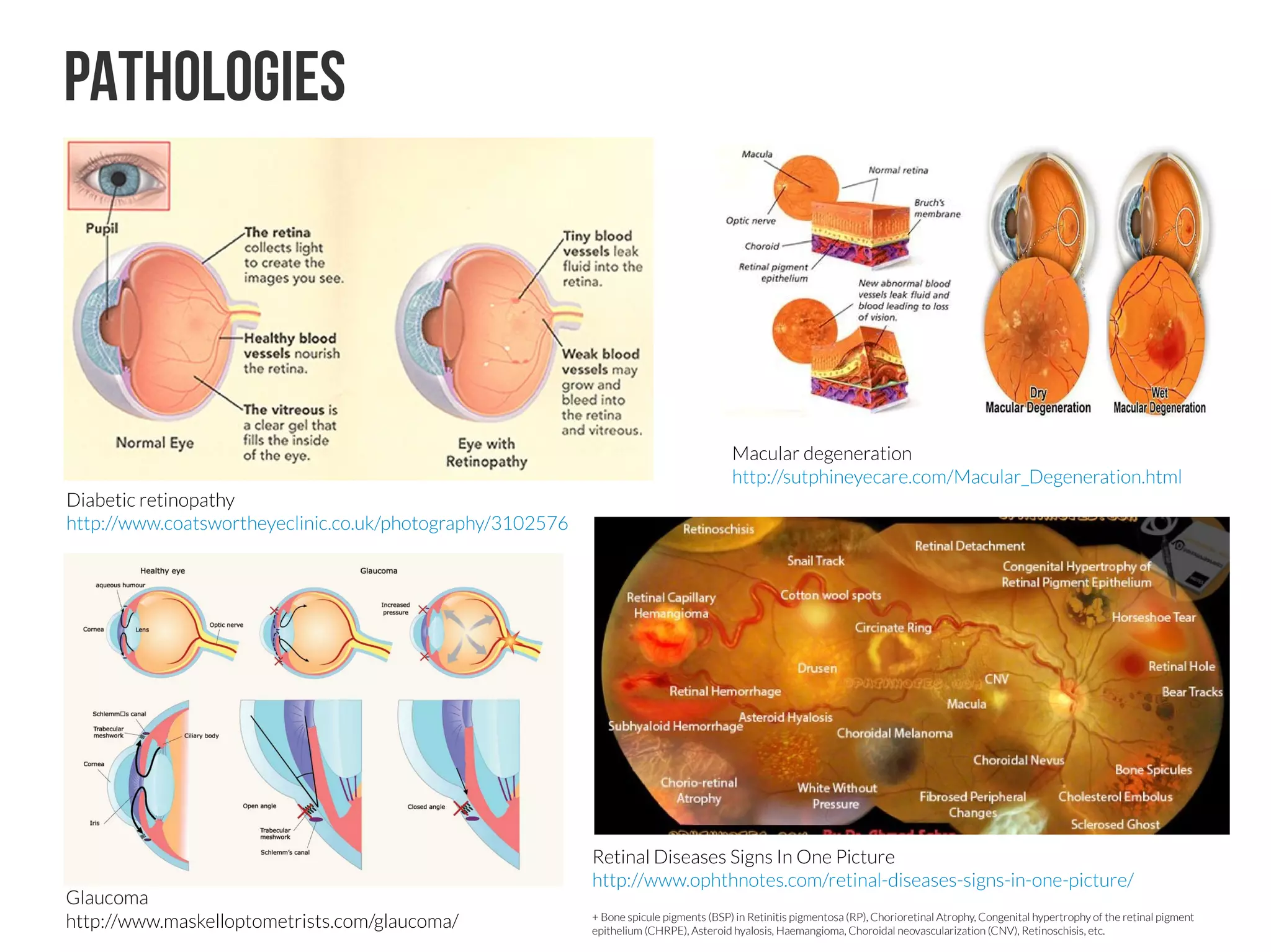 Shallow introduction for Deep Learning Retinal Image Analysis | PDF | Eye and Vision Conditions ...