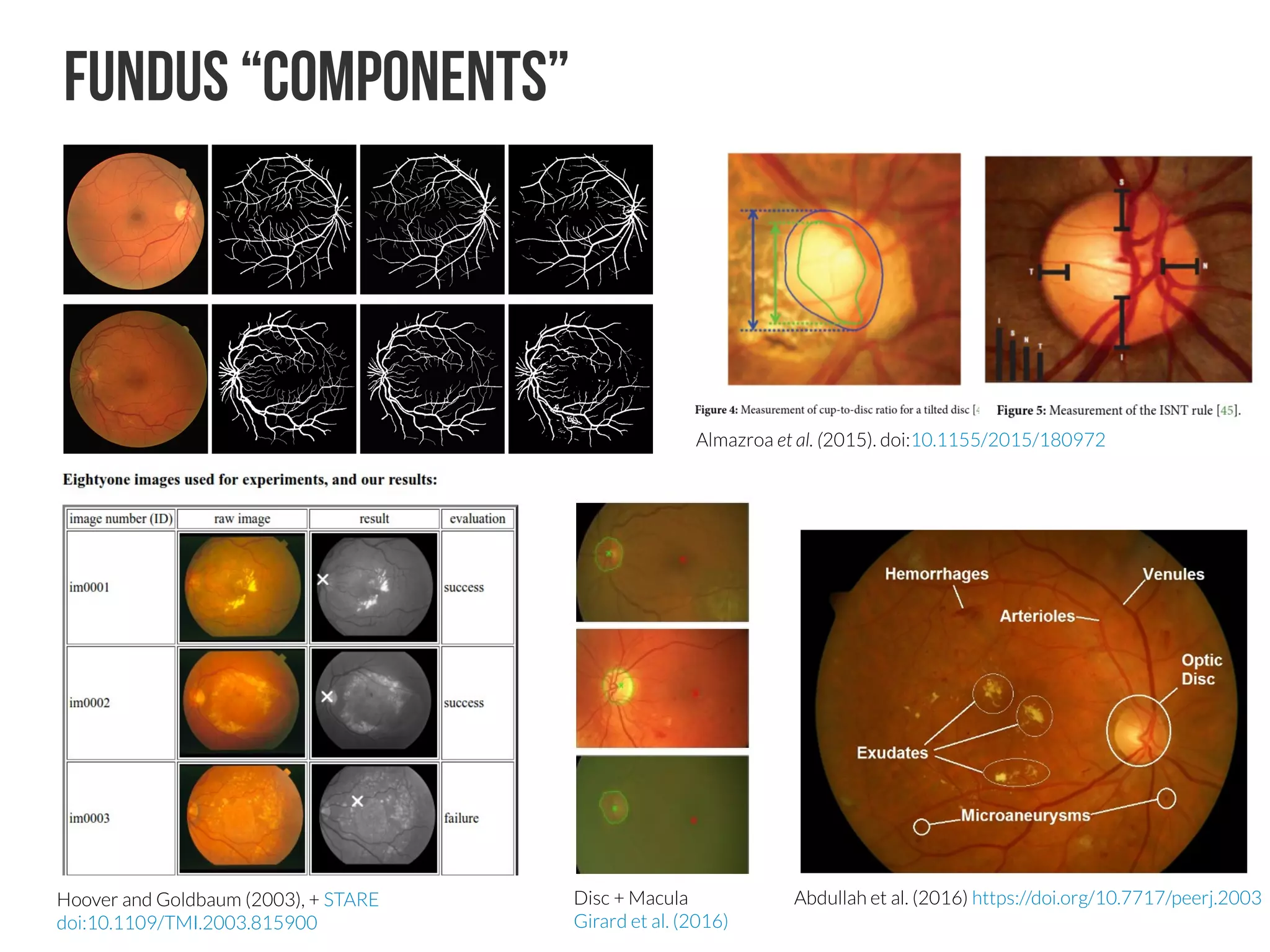 Shallow introduction for Deep Learning Retinal Image Analysis | PDF ...