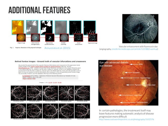 Shallow introduction for Deep Learning Retinal Image Analysis | PDF | Eye and Vision Conditions ...