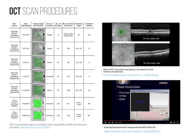 Shallow introduction for Deep Learning Retinal Image Analysis | PDF | Eye and Vision Conditions ...