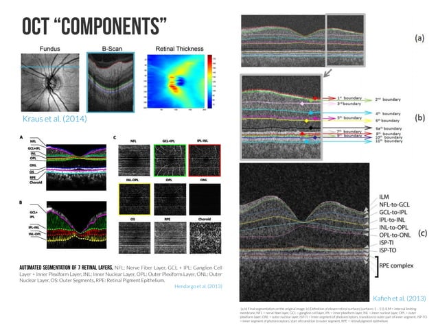 Shallow introduction for Deep Learning Retinal Image Analysis | PDF | Eye and Vision Conditions ...