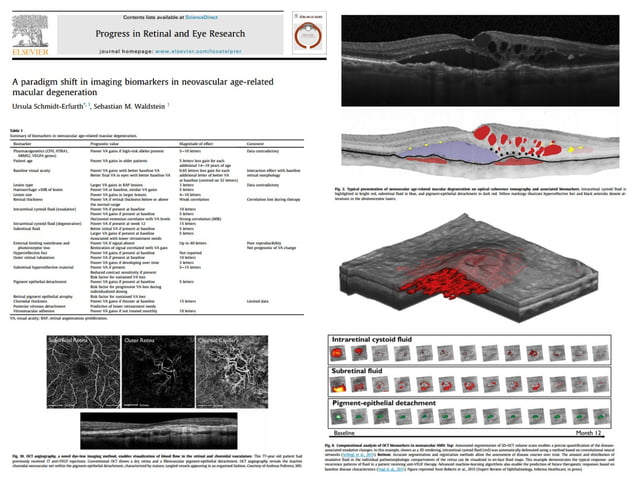 Shallow introduction for Deep Learning Retinal Image Analysis | PDF | Eye and Vision Conditions ...