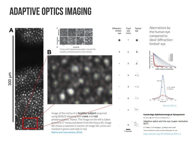 Shallow introduction for Deep Learning Retinal Image Analysis | PDF ...