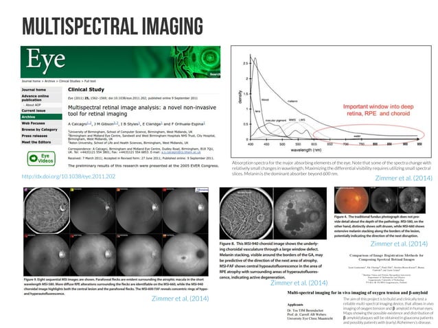 Shallow introduction for Deep Learning Retinal Image Analysis | PDF | Eye and Vision Conditions ...