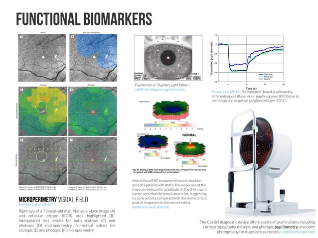 Shallow introduction for Deep Learning Retinal Image Analysis | PDF | Eye and Vision Conditions ...