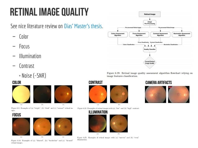 Shallow introduction for Deep Learning Retinal Image Analysis | PDF ...