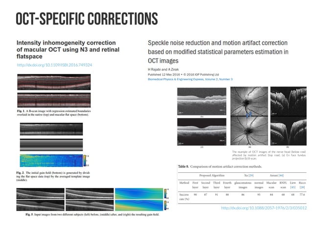 Shallow introduction for Deep Learning Retinal Image Analysis | PDF | Eye and Vision Conditions ...
