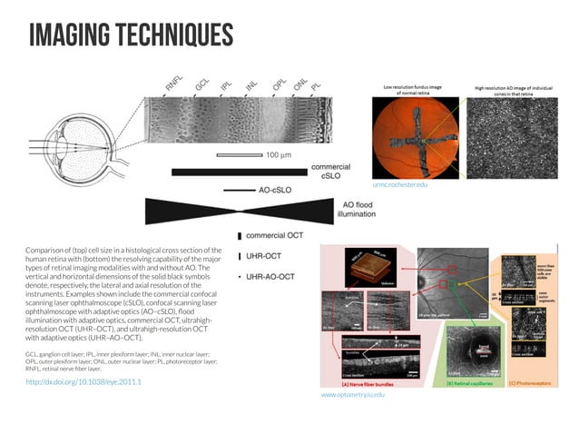 Shallow introduction for Deep Learning Retinal Image Analysis | PDF ...