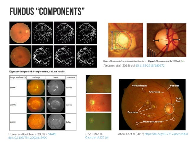 Shallow introduction for Deep Learning Retinal Image Analysis | PDF | Eye and Vision Conditions ...