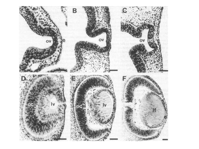 Retina embryology ppt | PPTX