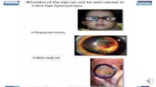 Retina fundus examination | PPTX
