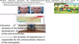 Retina hypertensive retinopathy | PPT