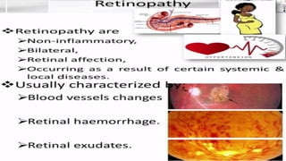 Retina hypertensive retinopathy | PPT