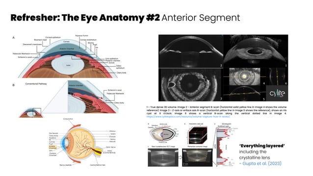 Next Gen Ophthalmic Imaging for Neurodegenerative Diseases and ...