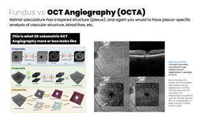 Next Gen Ophthalmic Imaging for Neurodegenerative Diseases and ...