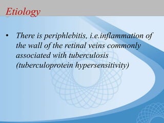 Periphlebitis Retinae [Eale’s Disease] | PPT