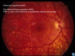 Retinal Conditions | PPS