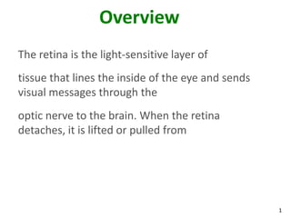 Retinal detachment | PPTX