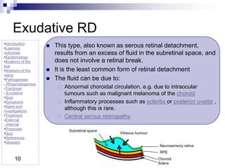 Retinal detachment | PPT