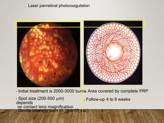 RETINAL-VASCULAR-DISORDERS.pdf