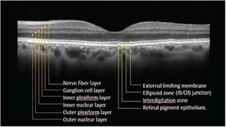 Retinal anatomy and physiology/ppt/ .pdf