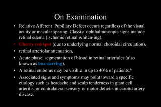 RETINAL ARTERY OCCLUSION , DR SAQUIB | PDF