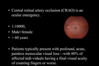 RETINAL ARTERY OCCLUSION , DR SAQUIB | PDF