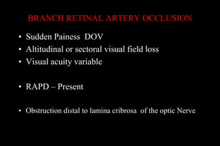 Branch Retinal Artery Occlusion Visual Field Defect