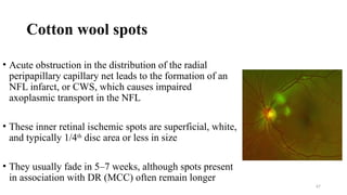 Retinal artery occlusion ppt............. | PPTX