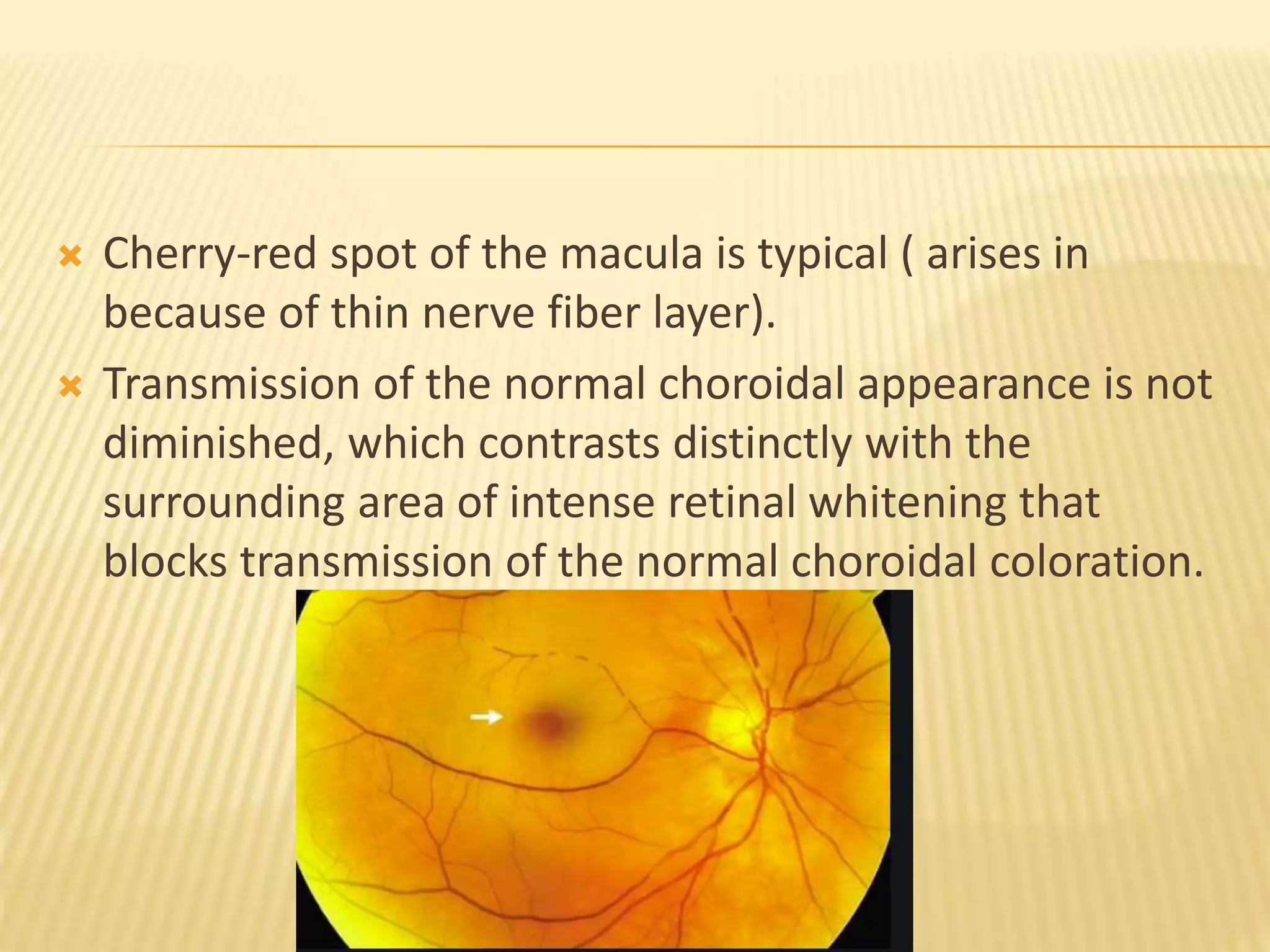 Retinal artery occlusions | PPTX